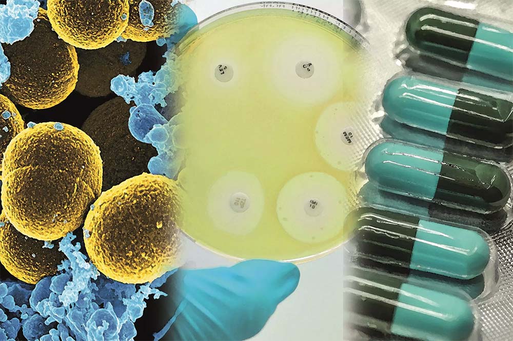 Averting AMR Protects Present, Secures the Future - Times Kuwait